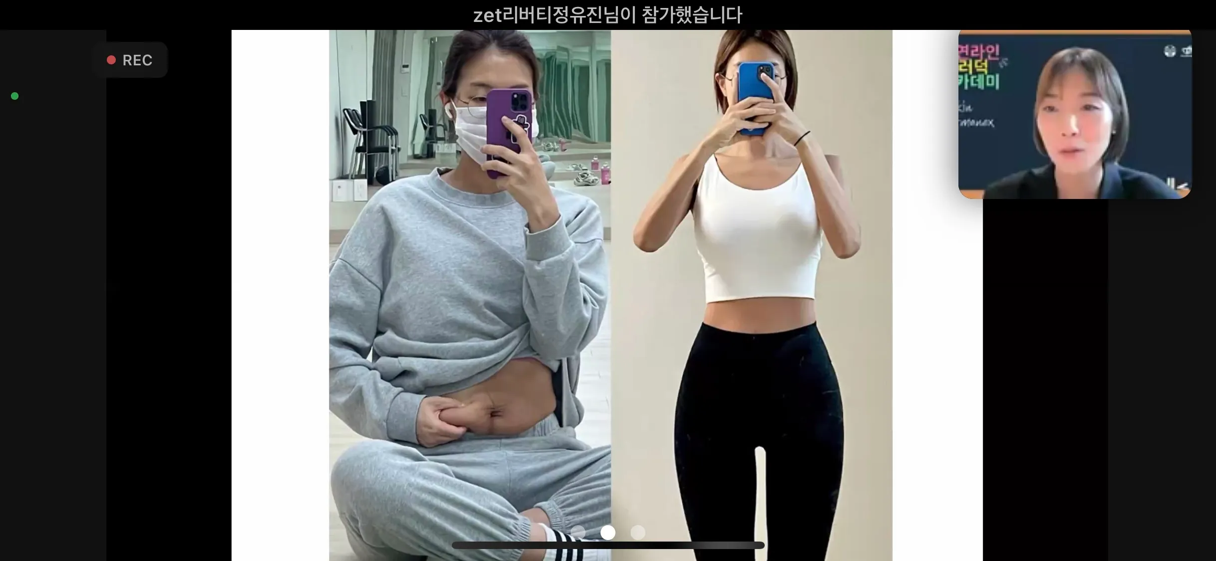 전신성형관리 김민 숨고 숨은고수