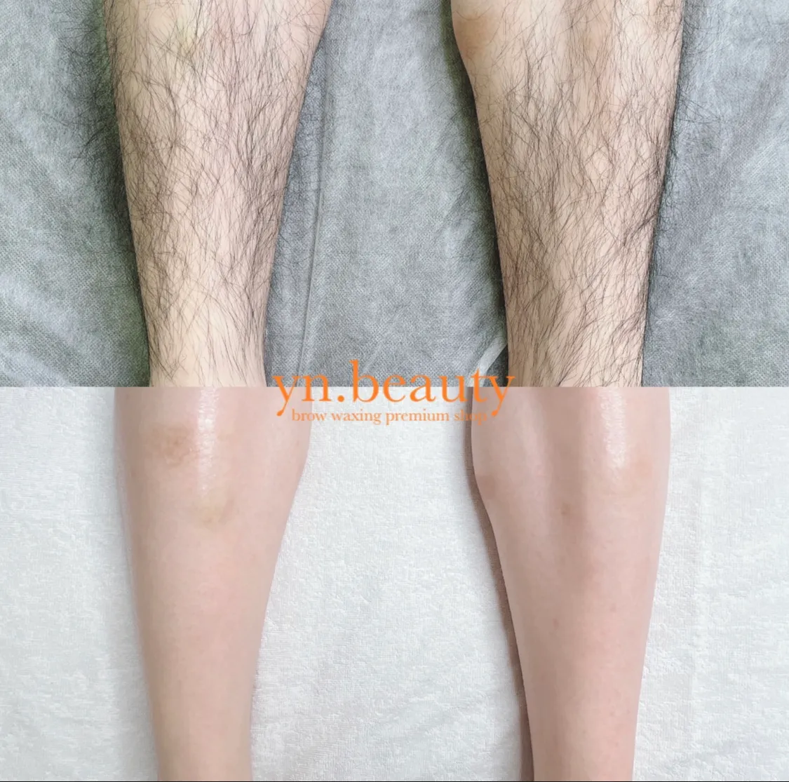 Yn beauty studio 왁싱😊 / 연놈토탈뷰티샵 - 숨고, 숨은고수