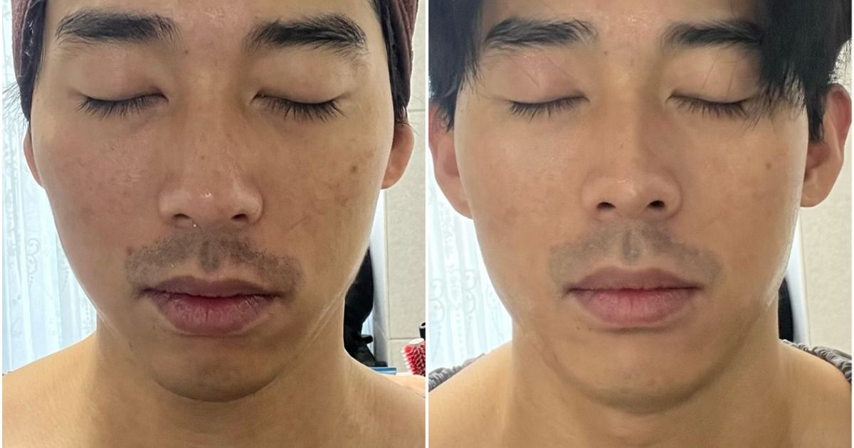 각질제거수분미백관리 설아 숨고 숨은고수