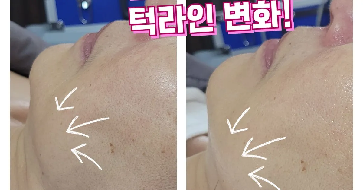 리프팅관리 올가드림뷰티 동산점 숨고 숨은고수