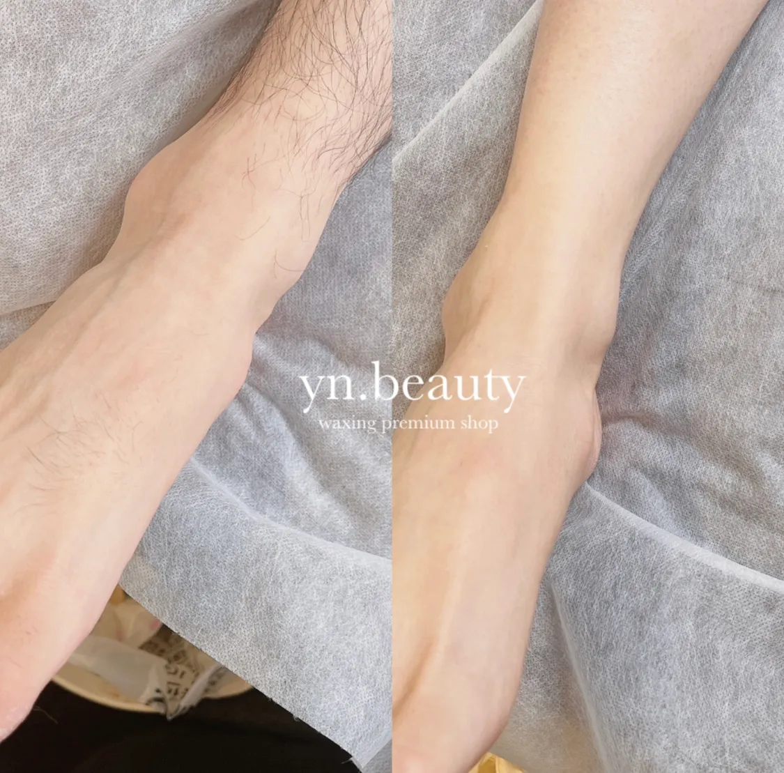 Yn beauty studio 왁싱😊 / 연놈토탈뷰티샵 - 숨고, 숨은고수