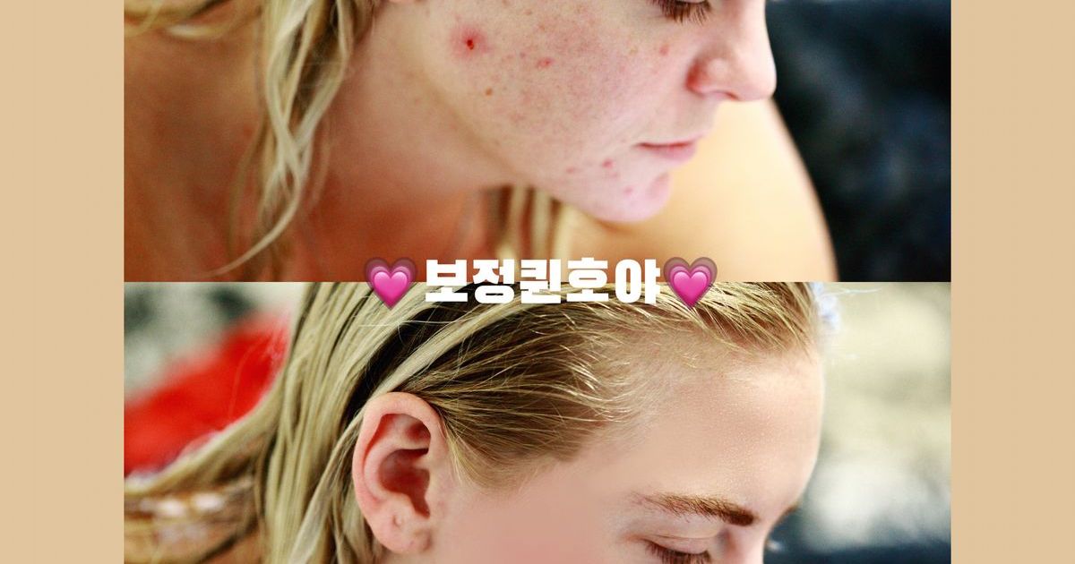 전후 사진 임효아 숨고 숨은고수