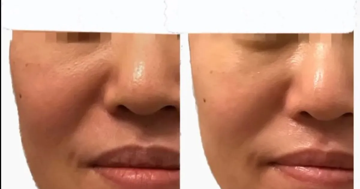 작은얼굴 발굴 관리 백승진 숨고 숨은고수