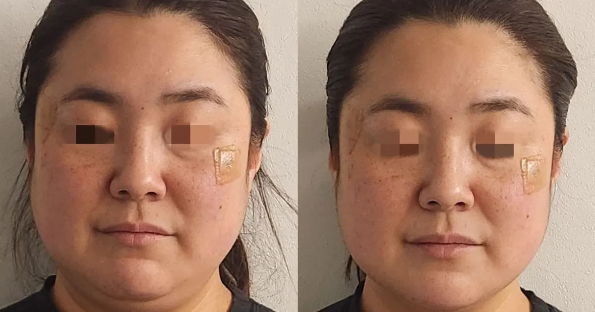 페이스관리 핑크플레이스 숨고 숨은고수
