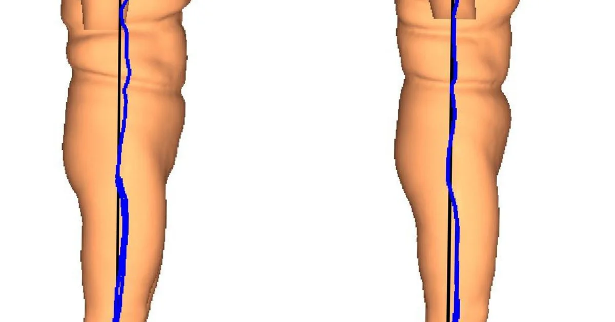 3d바디스캐너 검사를 통한 비포and에프터 필라테스me 숨고 숨은고수