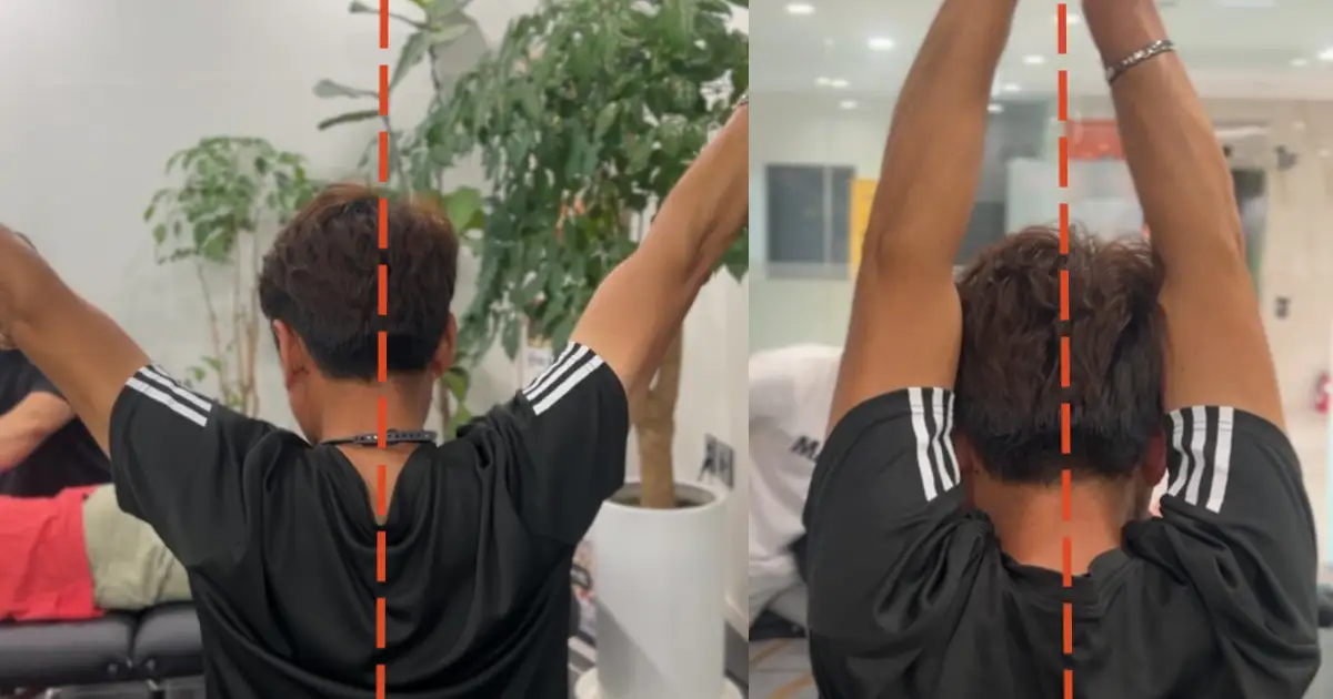 Before After 리바디체형교정센터 숨고 숨은고수