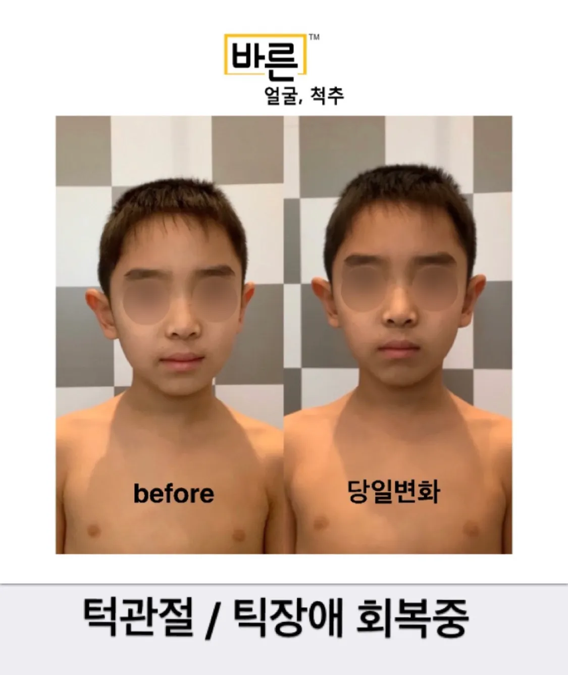 날씬하고 건강하고 예뻐지는 전국유일 운동 프로그램 날씬고 건강한 몸 예쁘고 건강한 얼굴 숨고 숨은고수