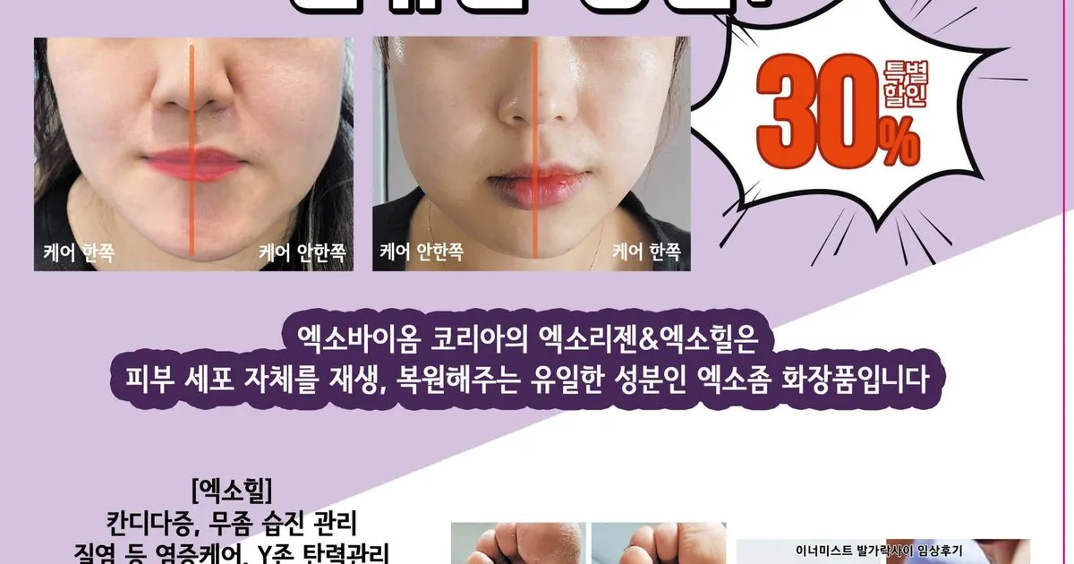 피부회복 대표적 사례 김은정 숨고 숨은고수