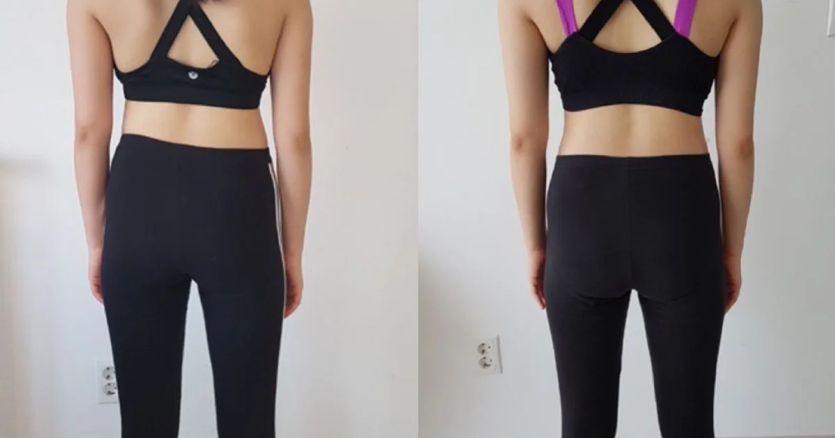 척추측만 교정 필라테스 Beforeandafter 박규나 숨고 숨은고수