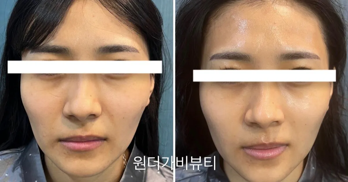 피부관리 윤곽관리 스킨리셋 숨고 숨은고수
