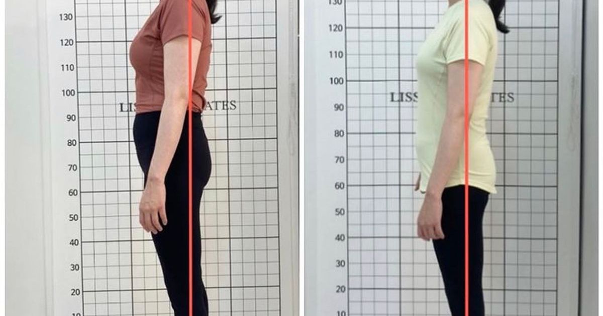 거북목 교정 박윤서 숨고 숨은고수
