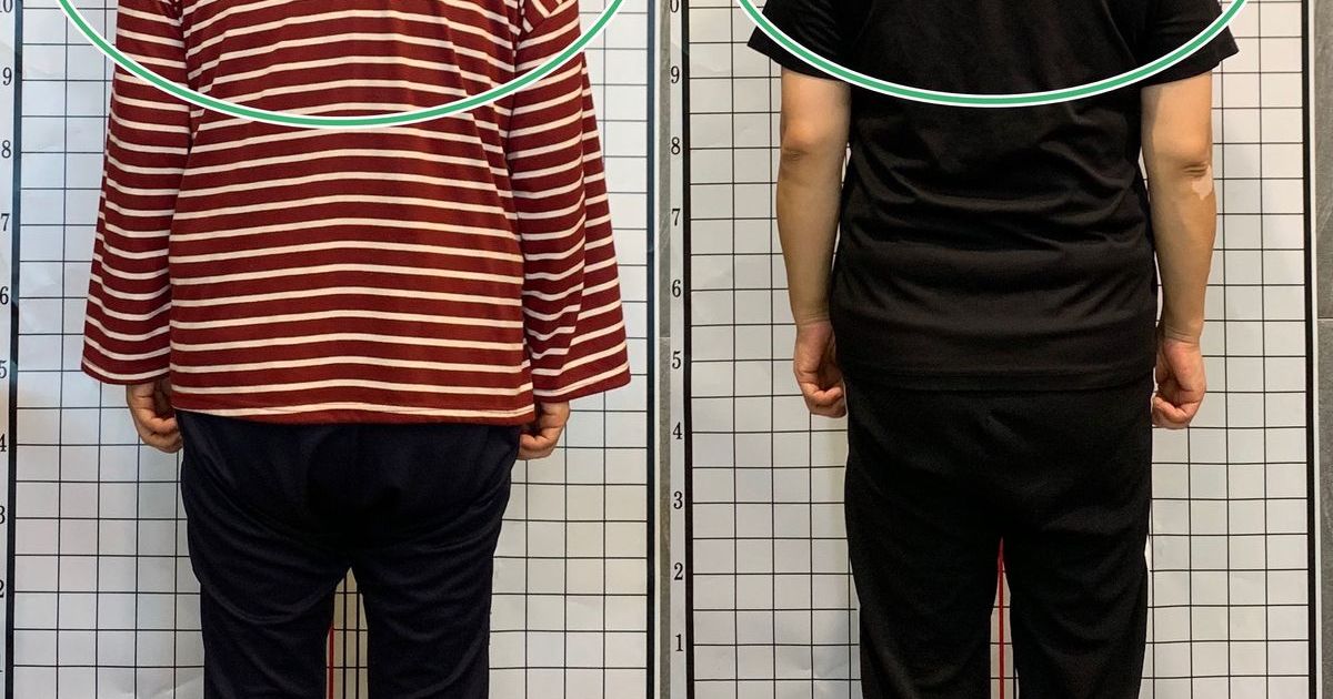 리뷰앤 비포앤에프터 홍준표 숨고 숨은고수
