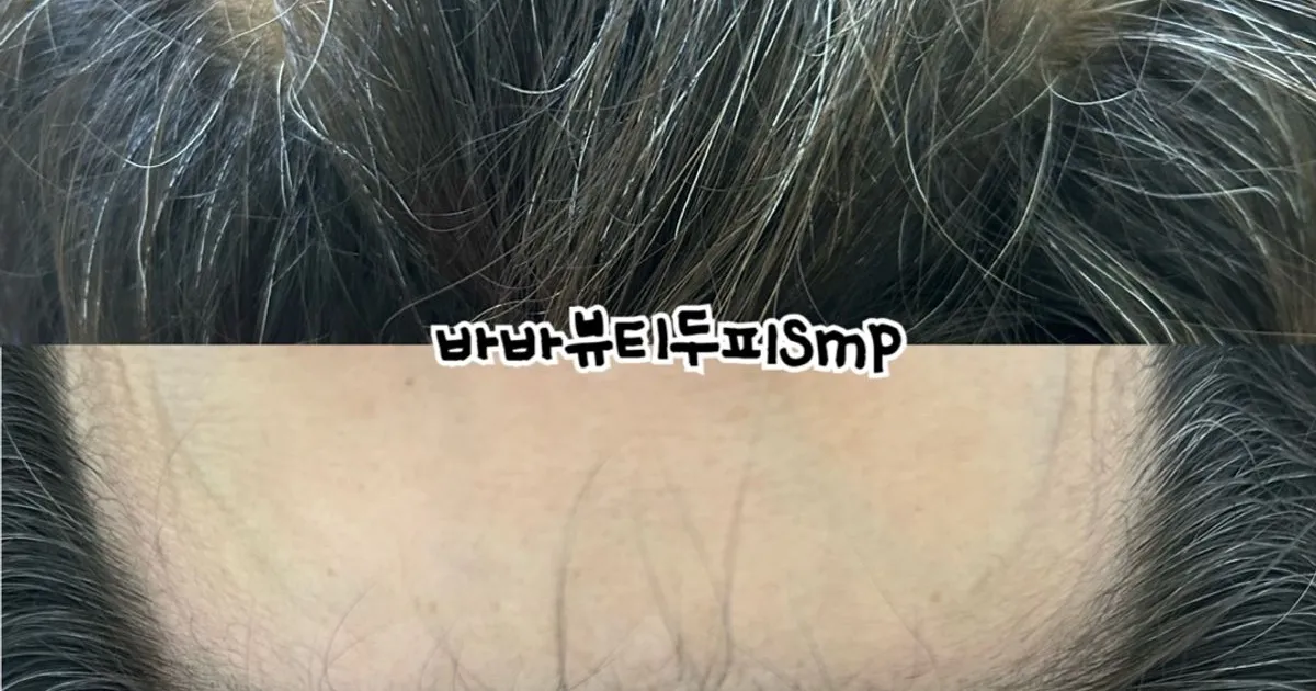 두피smp 이유진 숨고 숨은고수