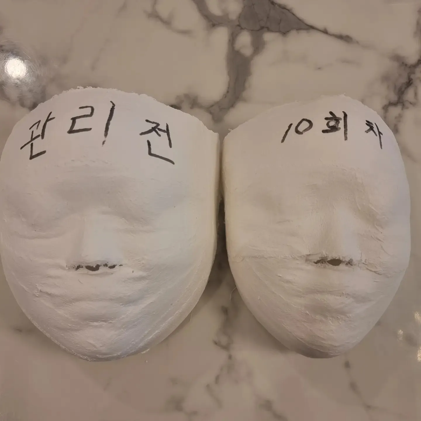윤곽관리전후 얼굴리프팅 광대축소 김정임 숨고 숨은고수