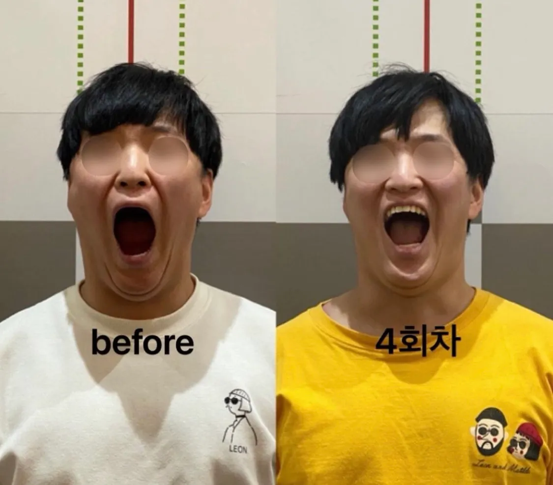 날씬하고 건강하고 예뻐지는 전국유일 운동 프로그램 날씬고 건강한 몸 예쁘고 건강한 얼굴 숨고 숨은고수