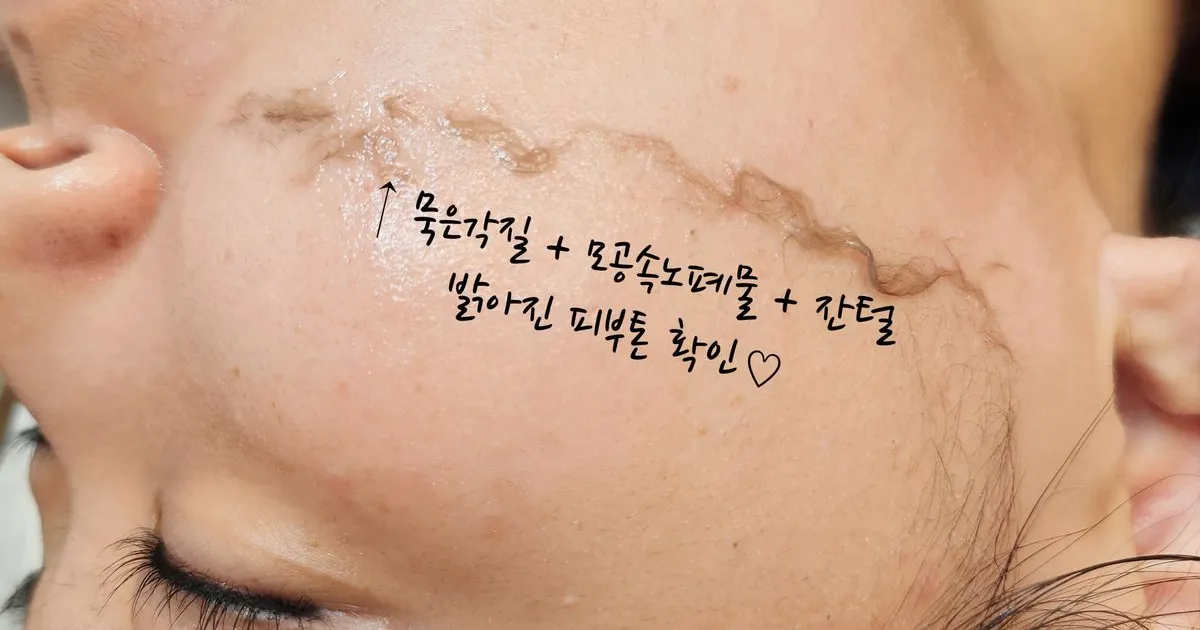 스킨플래닝 김세인 숨고 숨은고수
