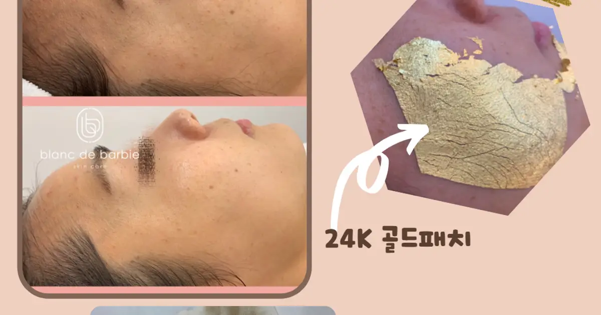 골드테라피 미백 독소배출안면거상마스크 블랑드바비 숨고 숨은고수