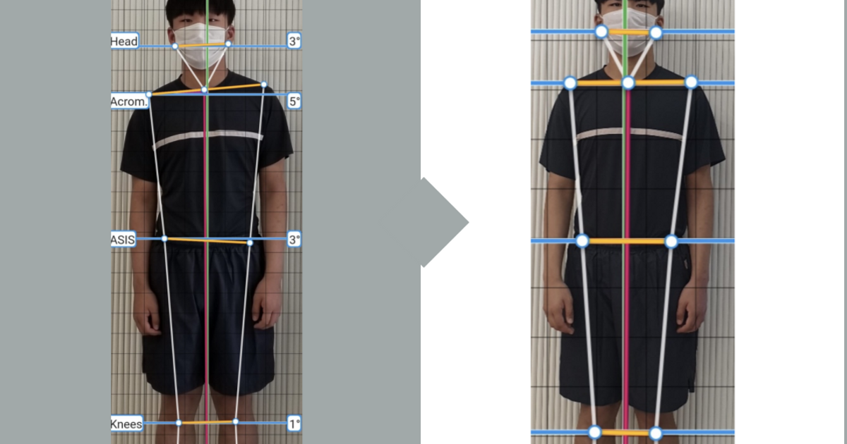 Beforeandafter 차인용 숨고 숨은고수