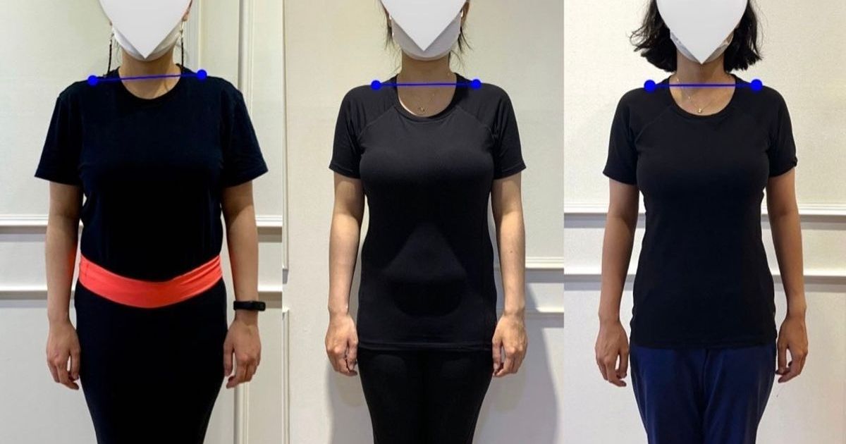 다이어트교정 Before And After 정현희 숨고 숨은고수