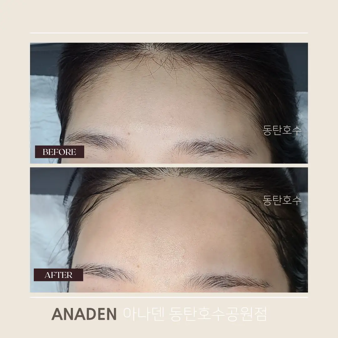 여자풀페이스 왁싱헤어라인 눈썹 이마인중볼 이승미 숨고 숨은고수