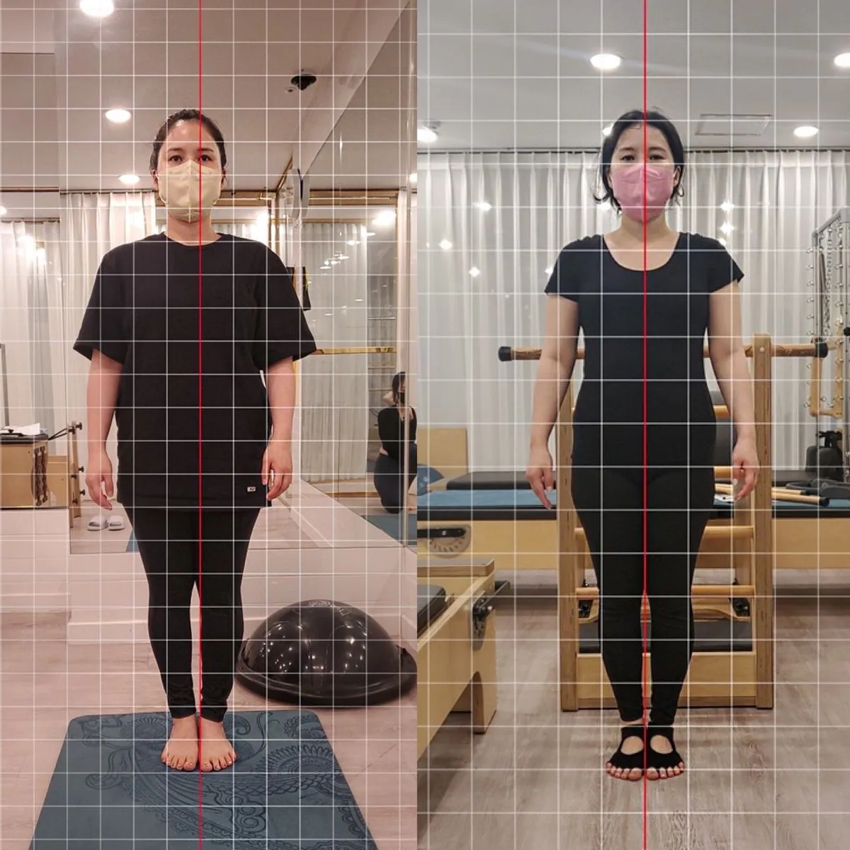 체형교정 Before And After 최소윤 원장 숨고 숨은고수