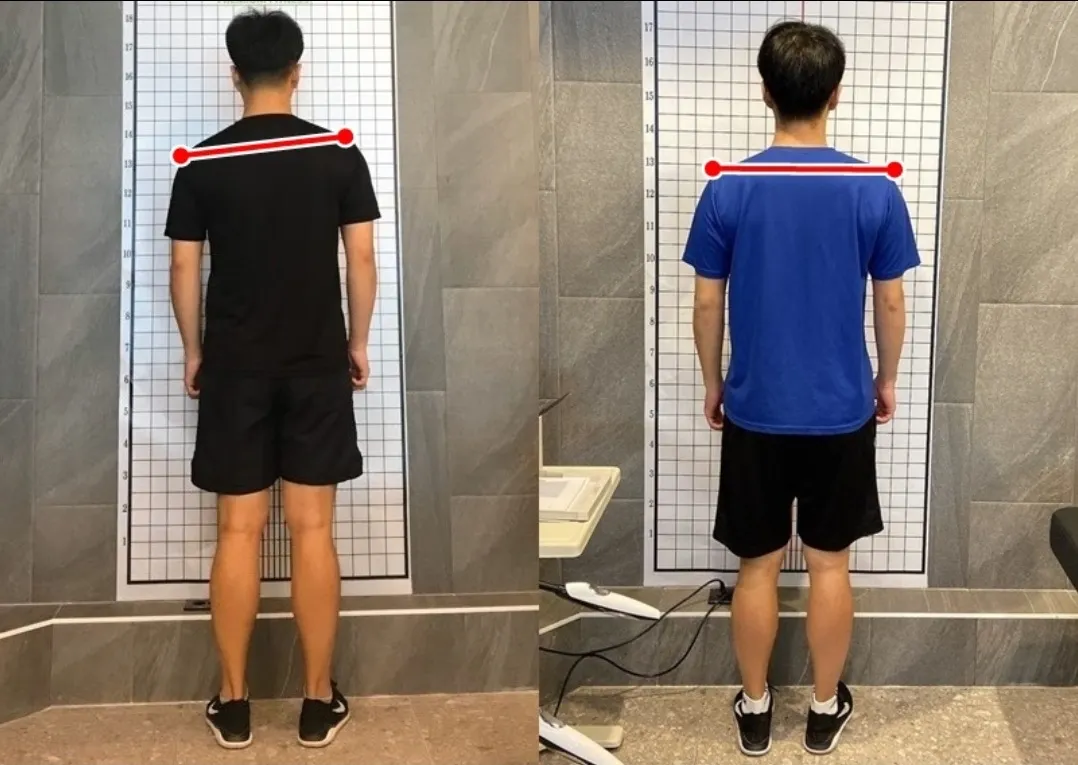 나의 Pt회원님들 비포 에프터 다이어트 포트폴리오 안형준 숨고 숨은고수