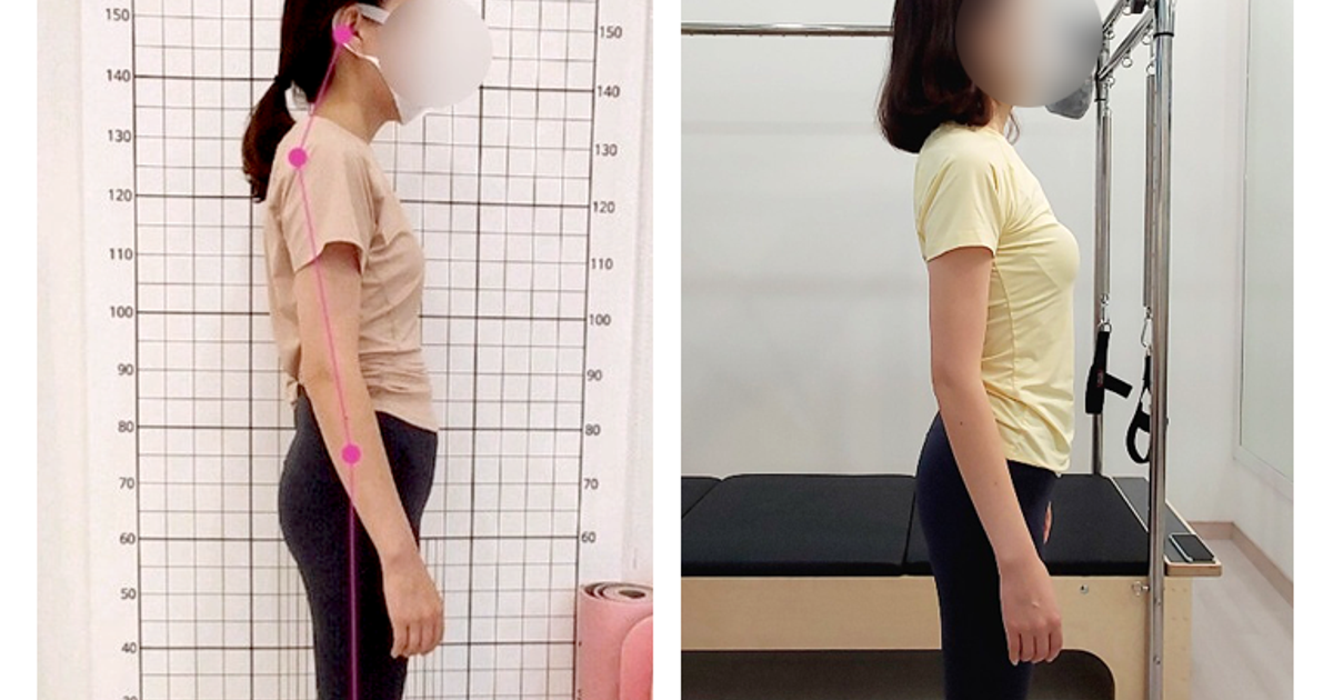 재활필라테스 Before Andafter 재활전문가 숨고 숨은고수