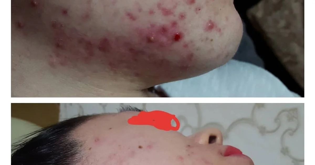 케어전후사진 안효주 숨고 숨은고수