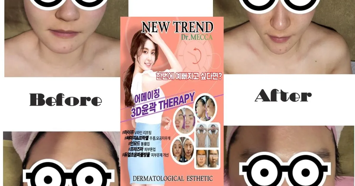 페이스관리 예스뷰티 숨고 숨은고수
