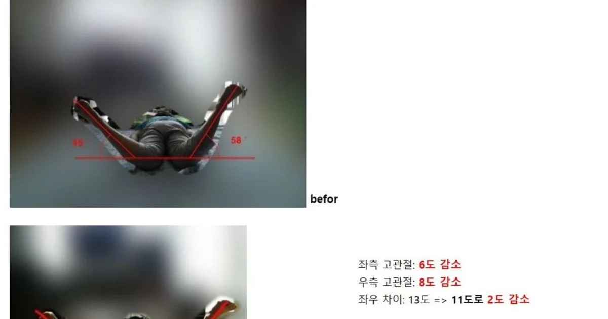 고관절 교정 테라피 방문요가 아룬다티 숨고 숨은고수