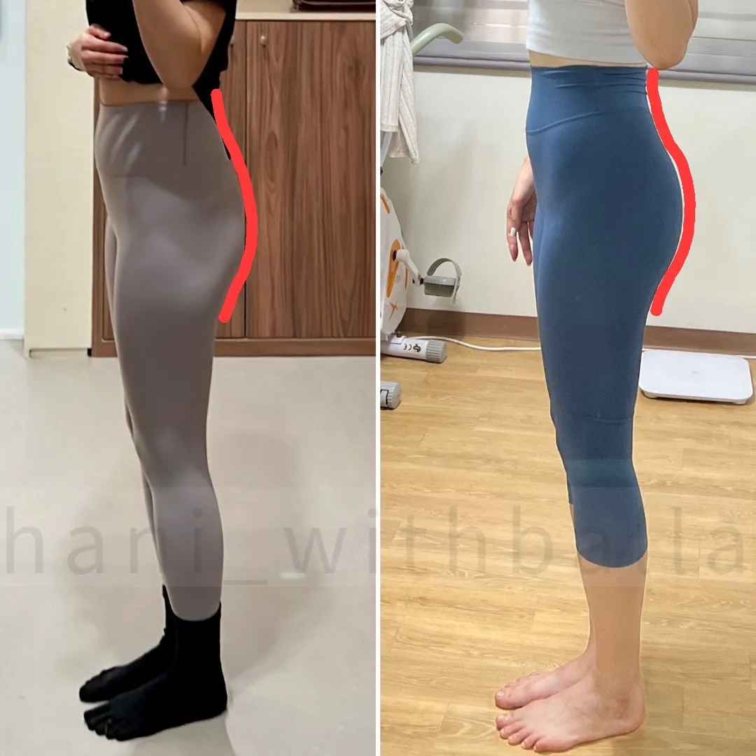Snpe 다이어트 체형교정 이주영 숨고 숨은고수