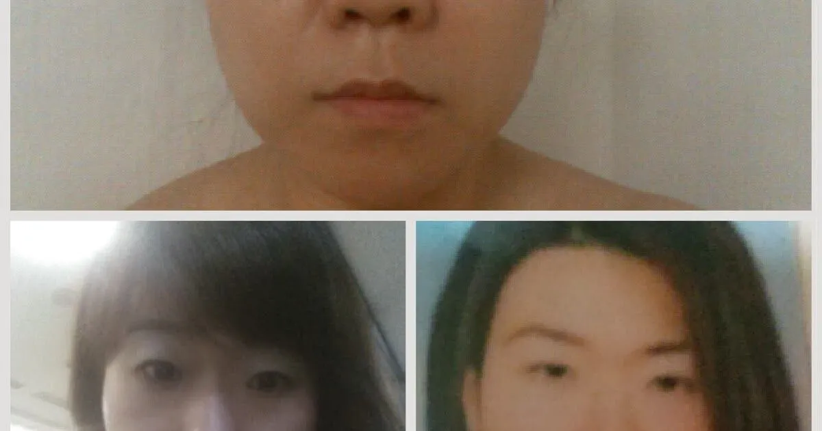 관리 전 후 사진 김은진 숨고 숨은고수
