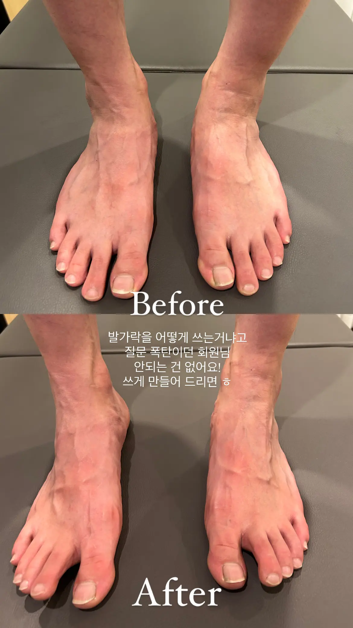회원님들 비포에프터 이현영 숨고 숨은고수