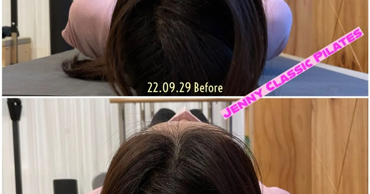 레슨 전후 비교 사진 제니 클래식 필라테스 숨고 숨은고수