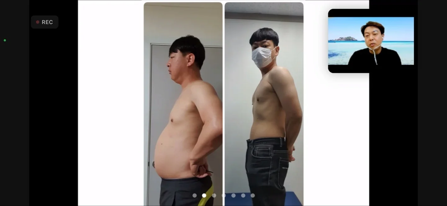 전신성형관리 김민 숨고 숨은고수