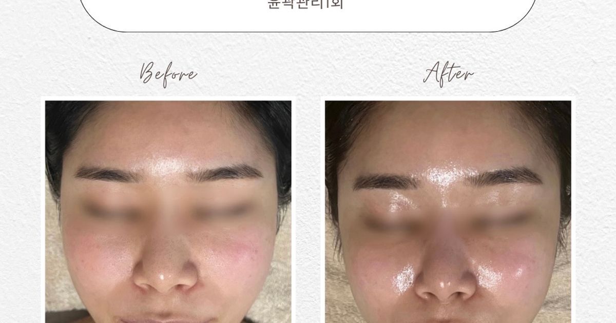 얼굴윤곽관리 신효림 숨고 숨은고수