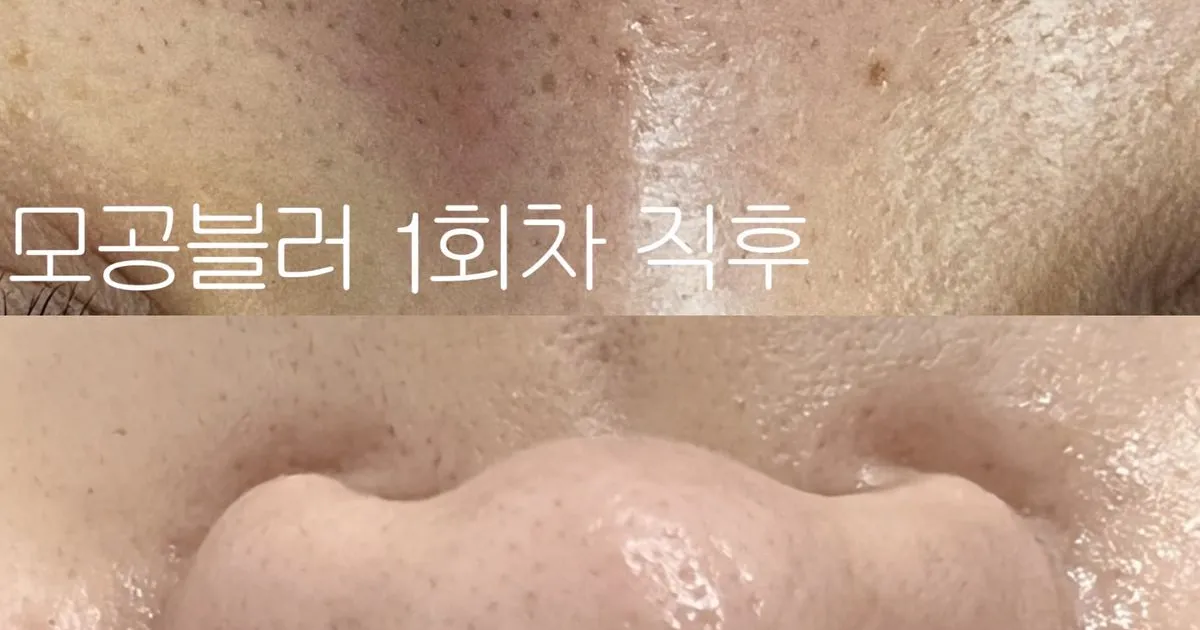 모찌모공블러 그몽몬 숨고 숨은고수
