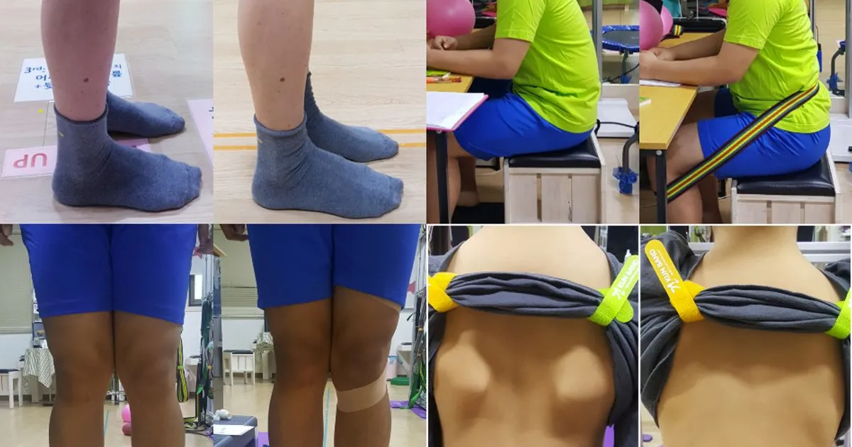 측만바른자세교정치료건밴드 재활통증성장 숨고 숨은고수