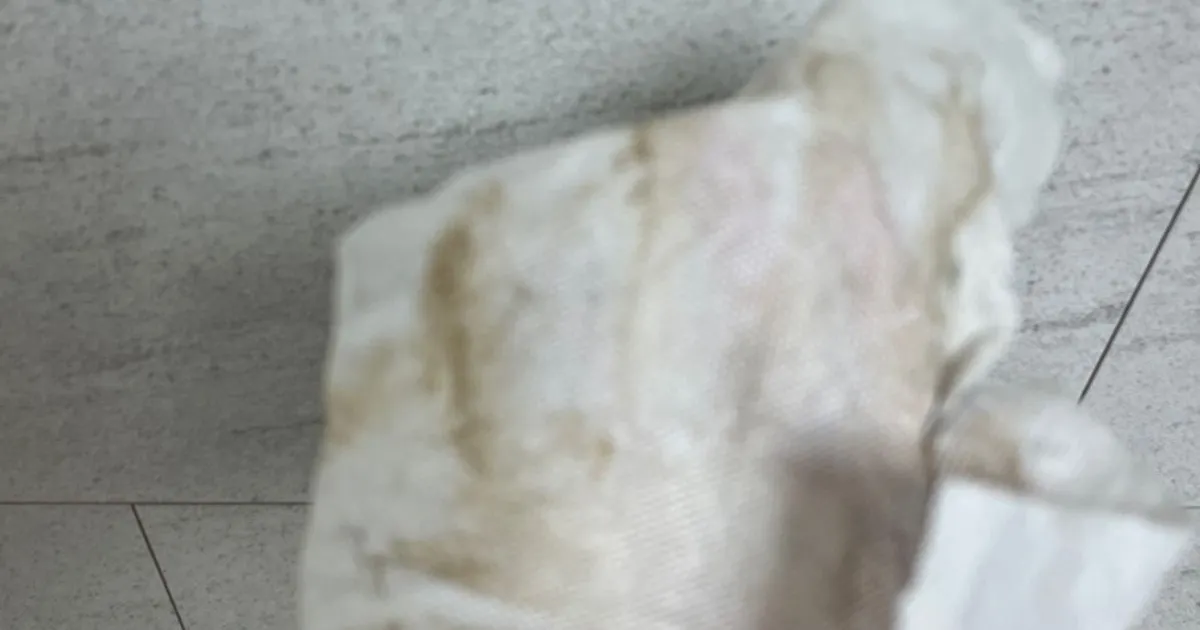 본사 대응이 황당하네요 미흡한 부분에 대해서 전화했으면 그냥 죄송하다고 하면 끝나는 문제인데 사과는커녕 그자리에서 말씀하시질그랬어요 라고 대응하던데 매우 불쾌하네요